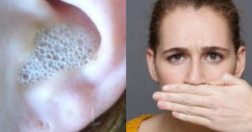 30 Clever Ways To Use Hydrogen Peroxide That You Didn’t Know Before ...