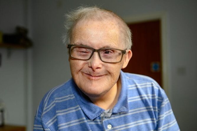 The Oldest Man With Down Syndrome Breaks Record By Turning 77 Years Old ...