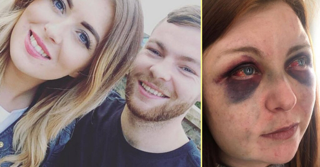 Abusive Fiance Almost Gouges Her Eyes Out So Nobody Would Want Her ...
