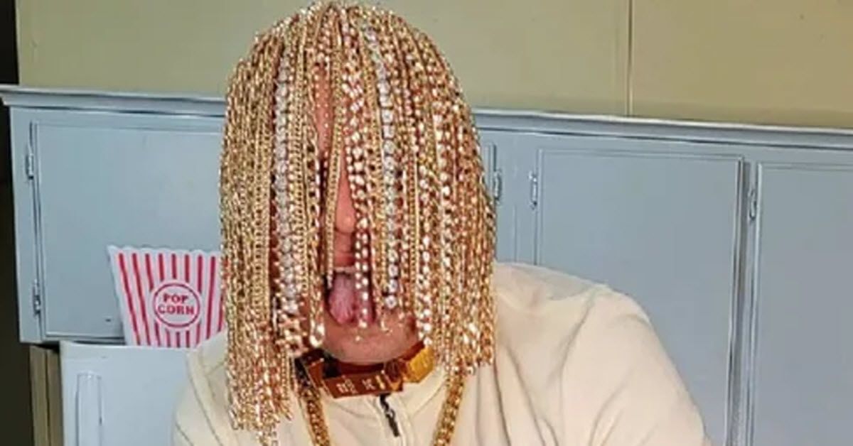 Rapper Has Surgery To Replace Hair With Gold Chains – InnerStrengthZone.com