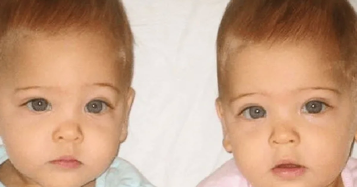 The ‘Most Beautiful’ Twins Have Now Grown Up – InnerStrengthZone.com