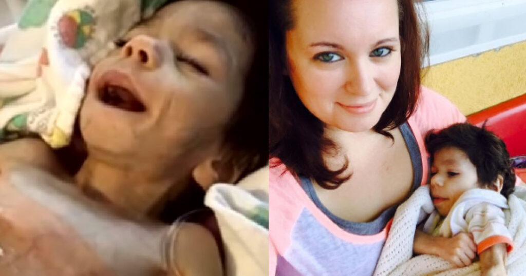 Woman Saves Then Offers Loving Home to Starving 8-Year Old Orphan Who ...