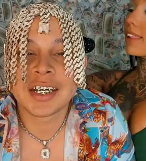 Rapper Shaves Head, Surgically Implants Gold Hooks Into Skull to Have ...