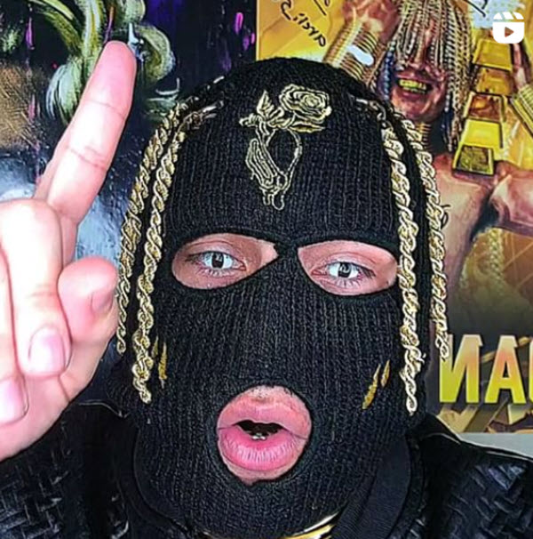 Rapper Shaves Head, Surgically Implants Gold Hooks Into Skull to Have ...