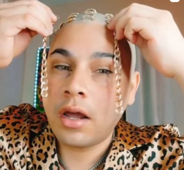 Rapper Shaves Head, Surgically Implants Gold Hooks Into Skull to Have ...